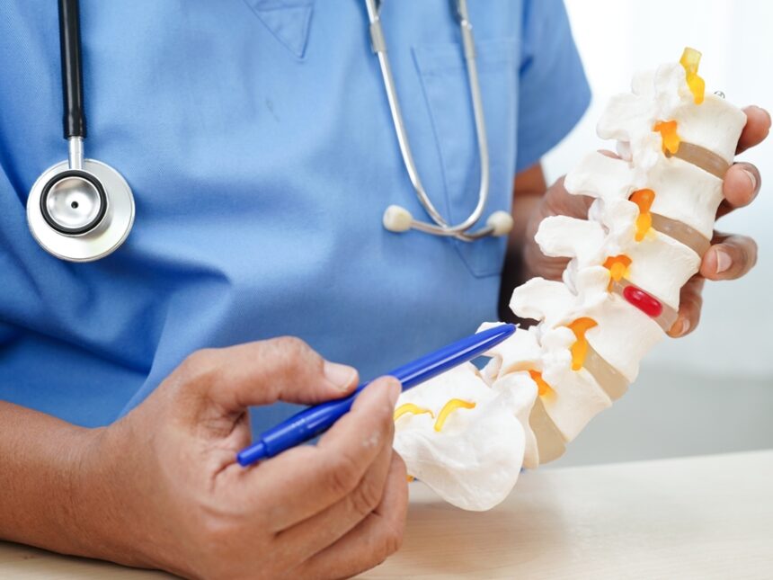 Discectomy Dos and Don'ts: Your Guide to a Speedy Recovery - NEURO